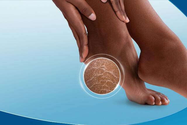 Skincare Products for Irritated Chapped Skin | Cetaphil US